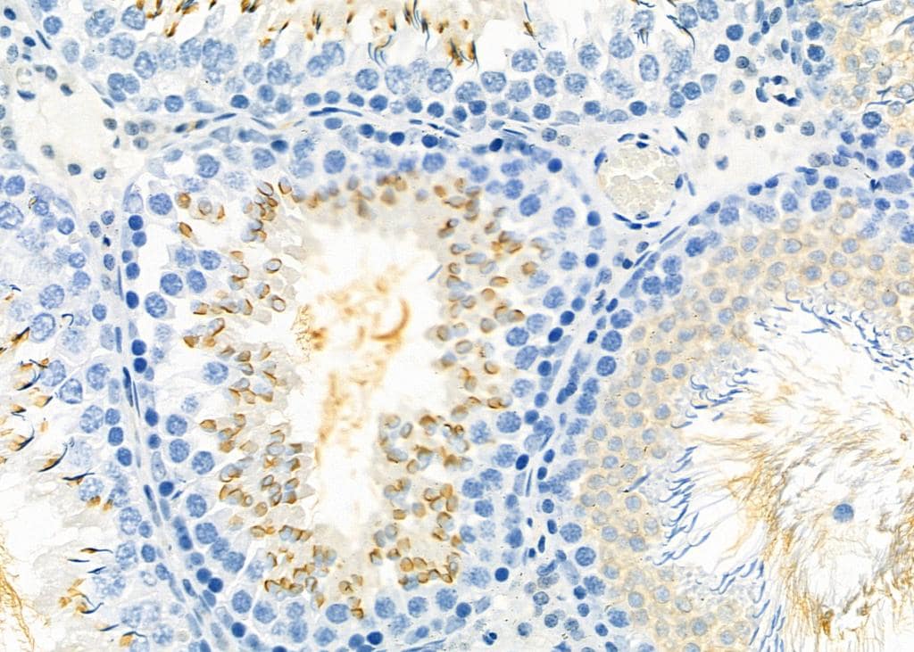 IBSP Antibody (PA5-114915)