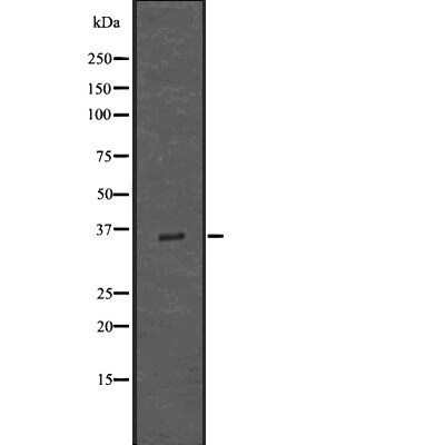 IBSP Antibody (PA5-114915)