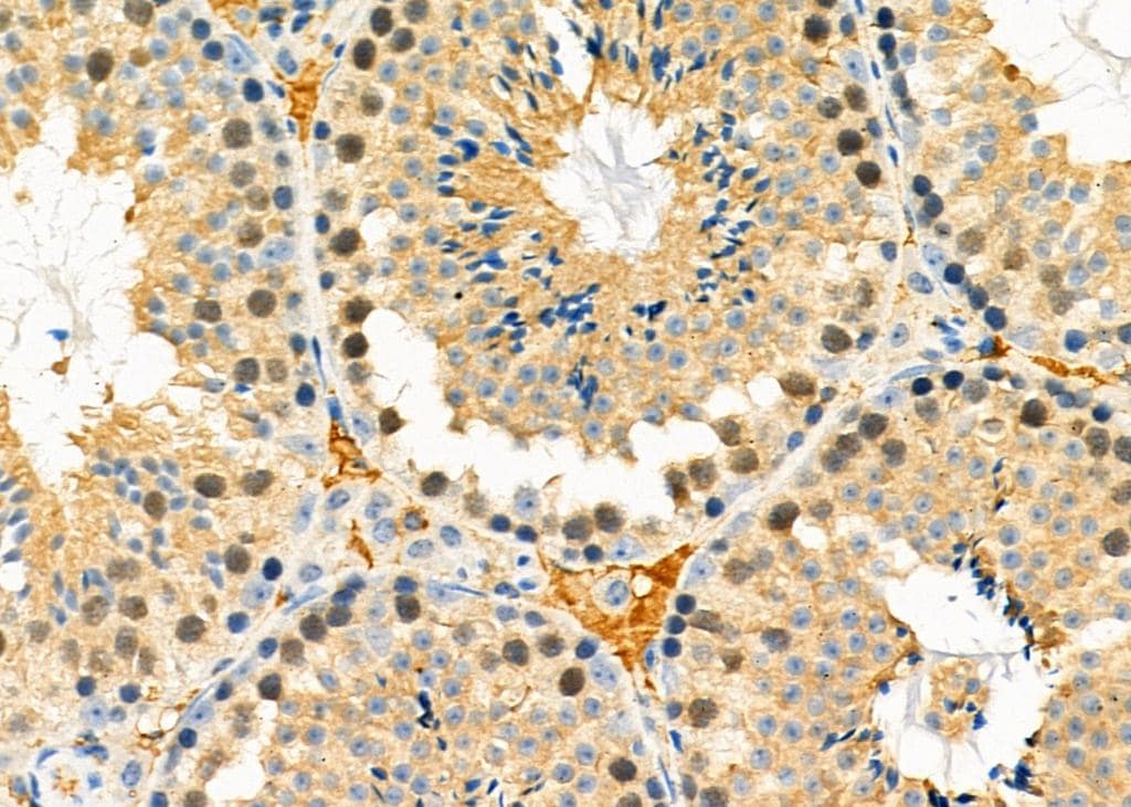 FABP4 Antibody (PA5-115206)