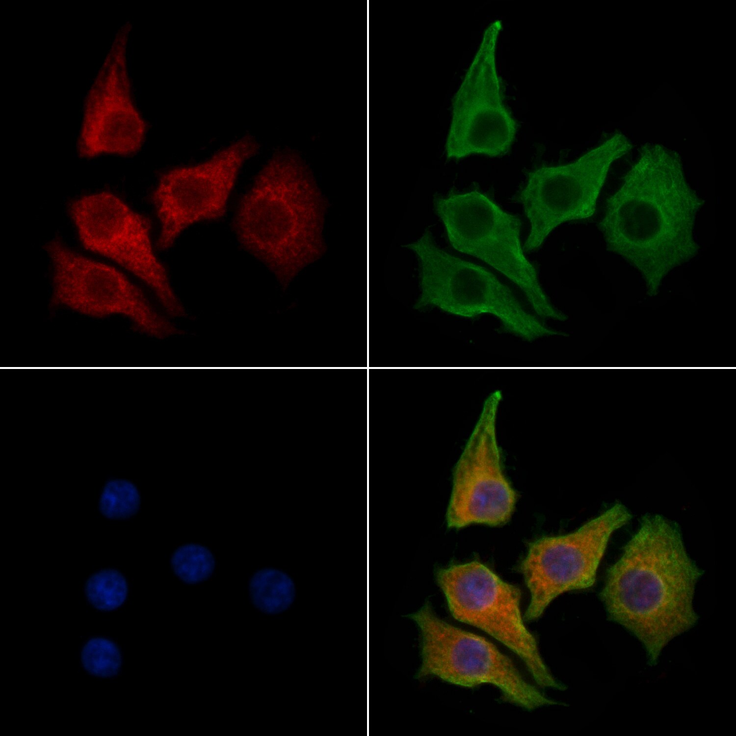 FUCA1 Antibody (PA5-115256)