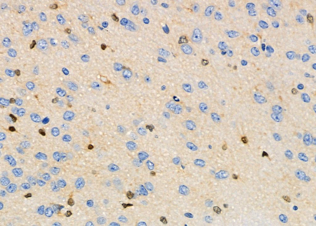 LC3B Antibody (PA5-115501)