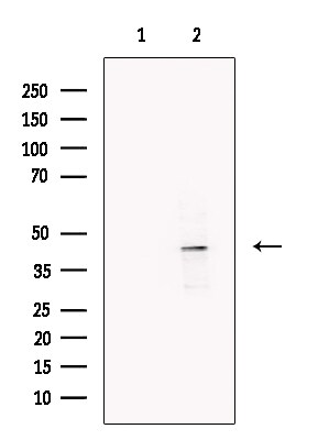 LMX1A Antibody (PA5-115517)