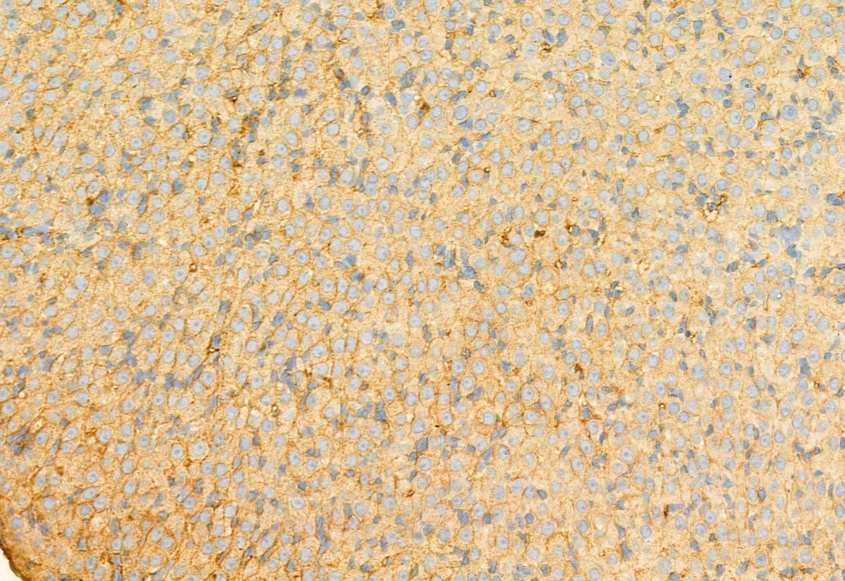 MCP-1 Antibody (PA5-115555)