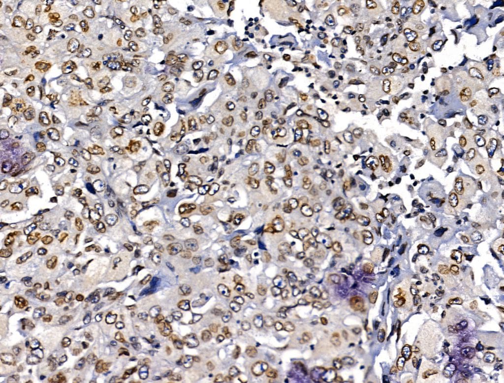 MUM1 Antibody (PA5-115603)