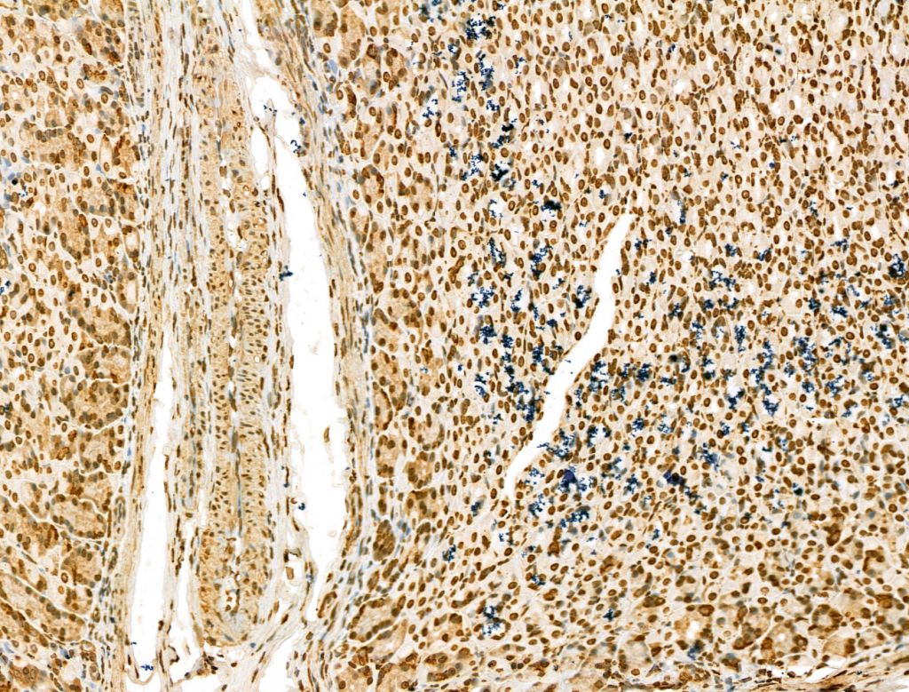 SCXA Antibody (PA5-115874)