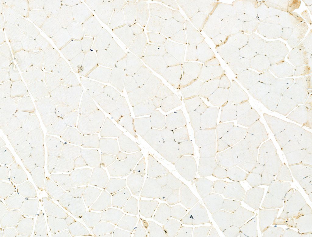 SCXA Antibody (PA5-115874)