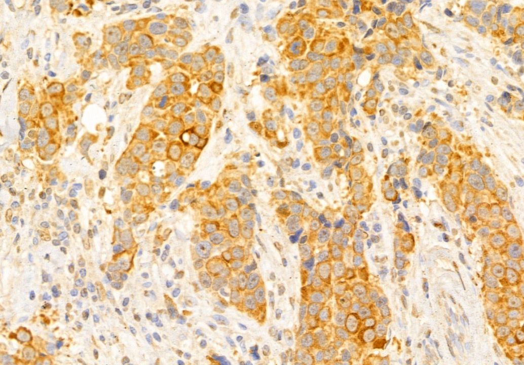 SLC7A11 Antibody (PA5-116134)