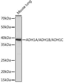 ADH1A/ADH1B/ADH1C Antibody (PA5-116865)