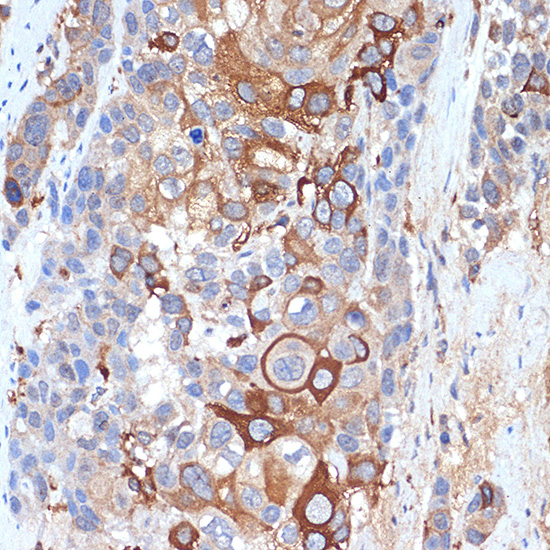 SIGLEC15 Antibody (PA5-116878)