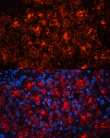 NGAL Antibody (PA5-116987)