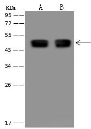 GFAP Antibody (PA5-117966)