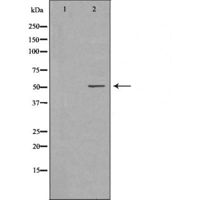 MMP8 Antibody (PA5-118598)