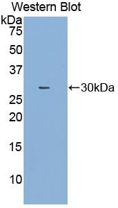 NOSIP Antibody (PA5-119309)