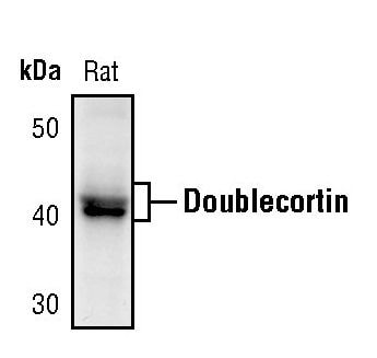 Doublecortin Antibody (PA5-17428)