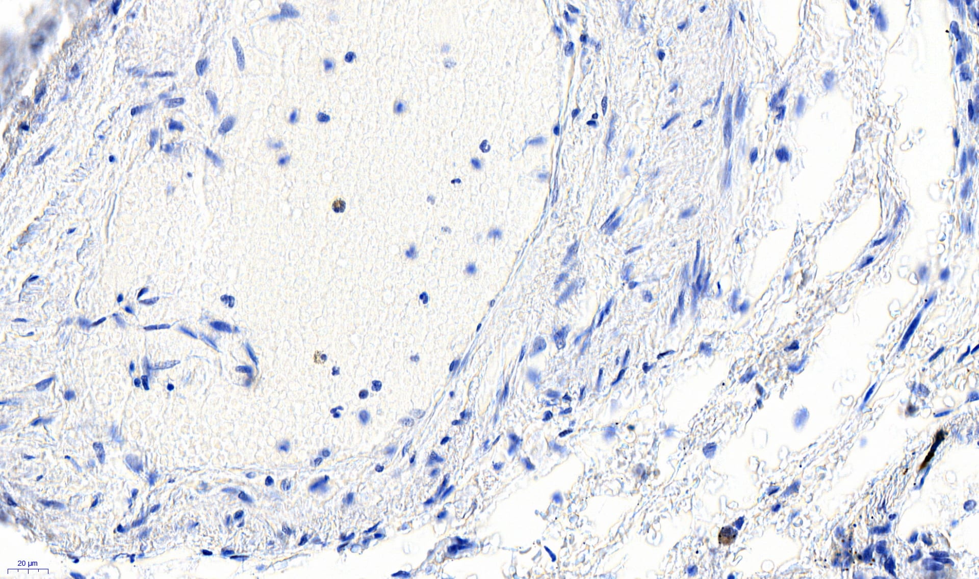 Alpha-Smooth Muscle Actin Antibody (PA5-18292)