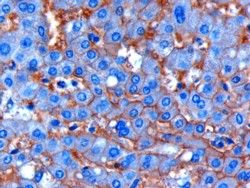 ENPP1 Antibody (PA5-18429)