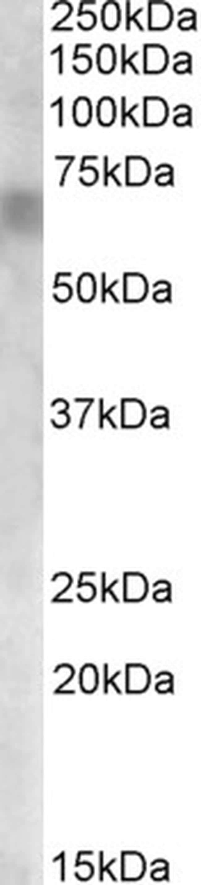 RPE65 Antibody (PA5-18890)