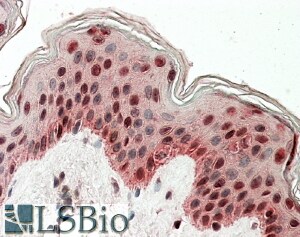 TIA1/TIAL1 Antibody (PA5-19240)