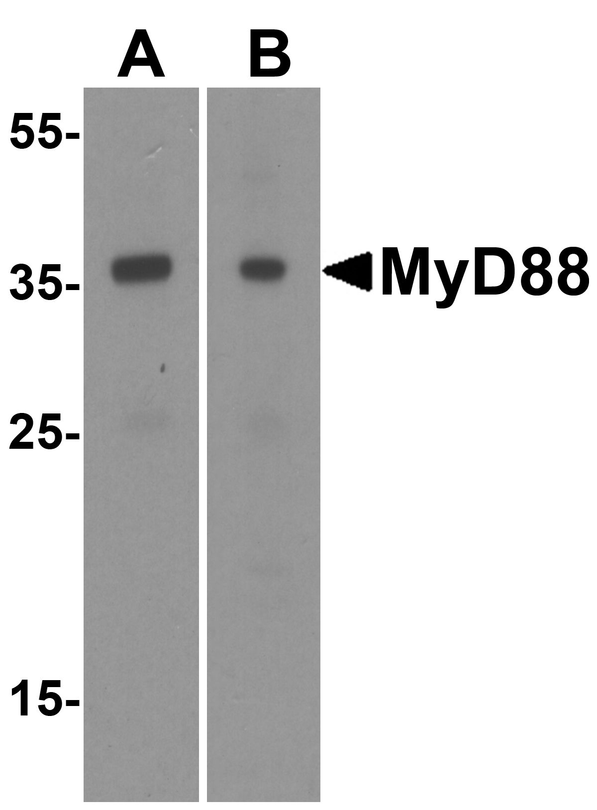 MyD88 Antibody (PA5-19918)