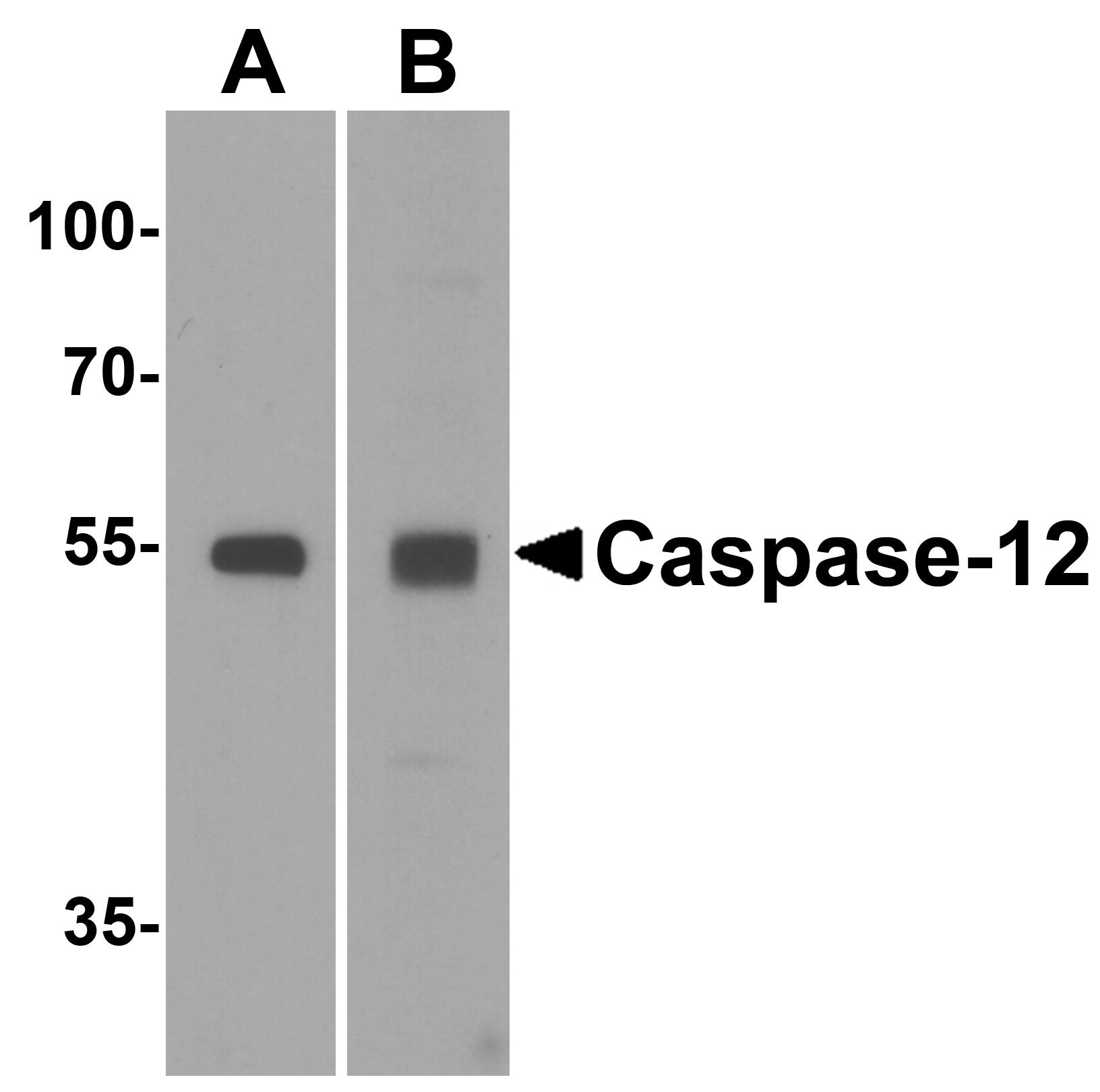 Caspase 12 Antibody (PA5-19963)