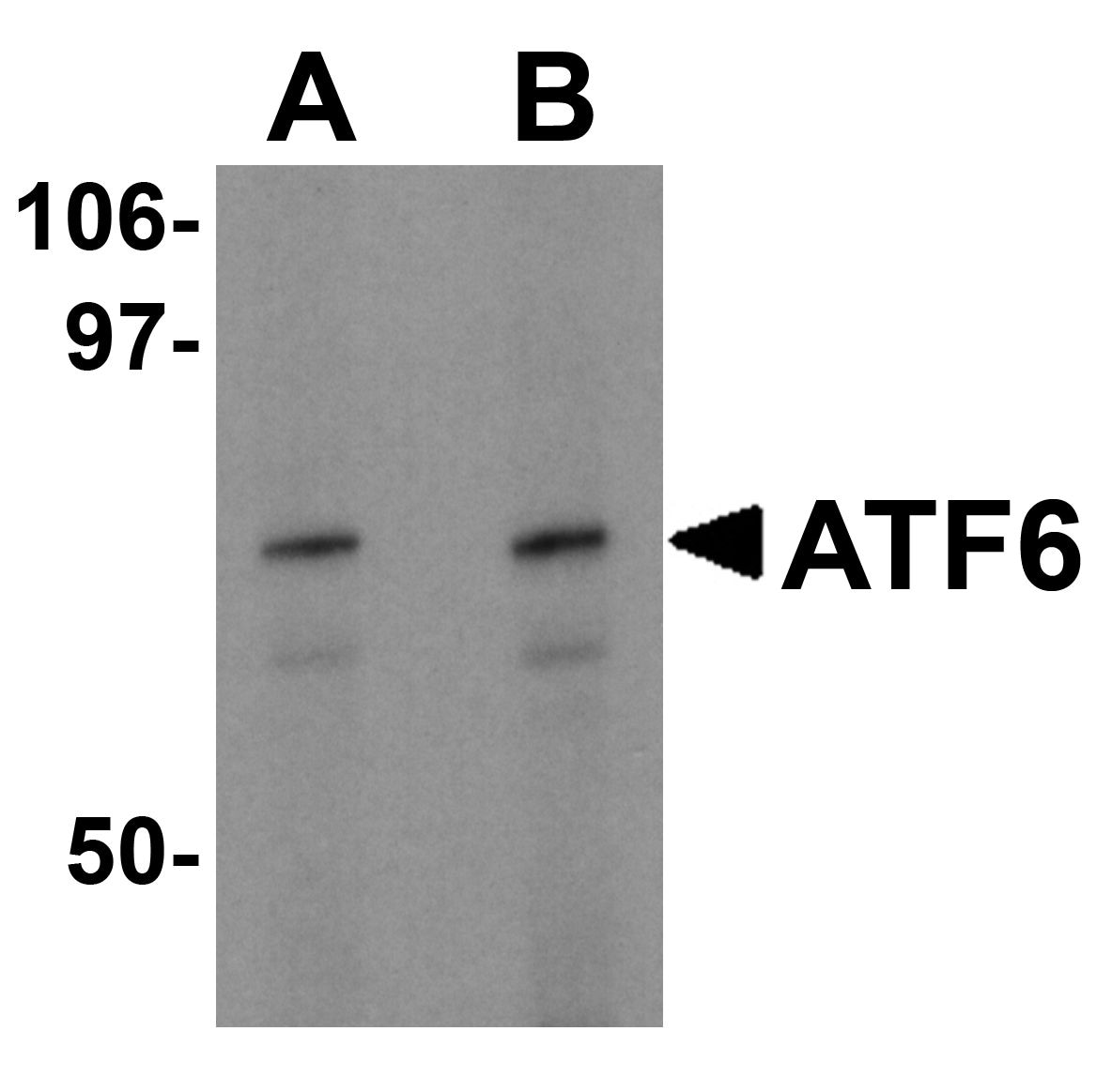 ATF6 Antibody (PA5-20215)
