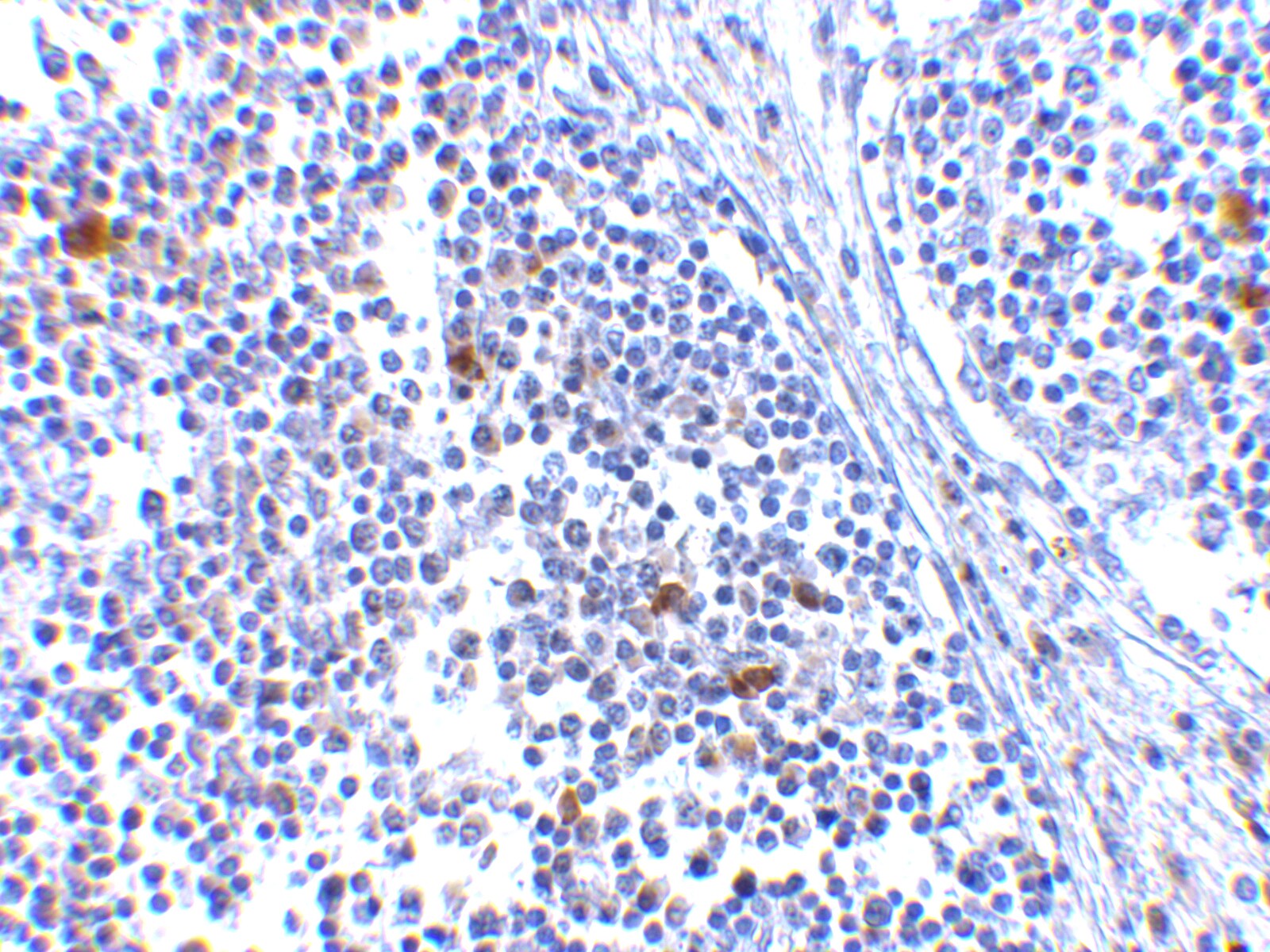 MDA5 Antibody (PA5-20338)