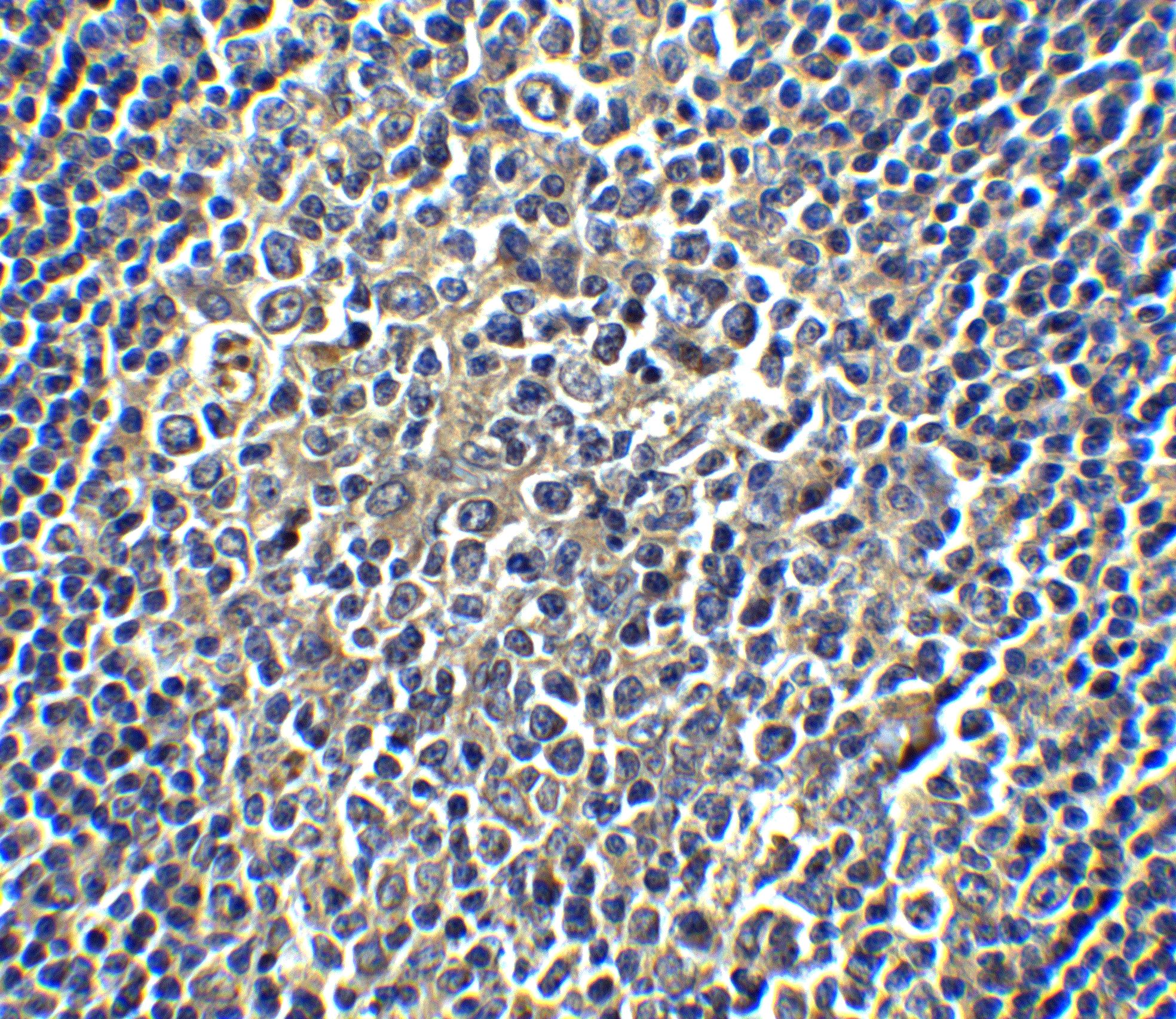 PD-L1 Antibody (PA5-20343)