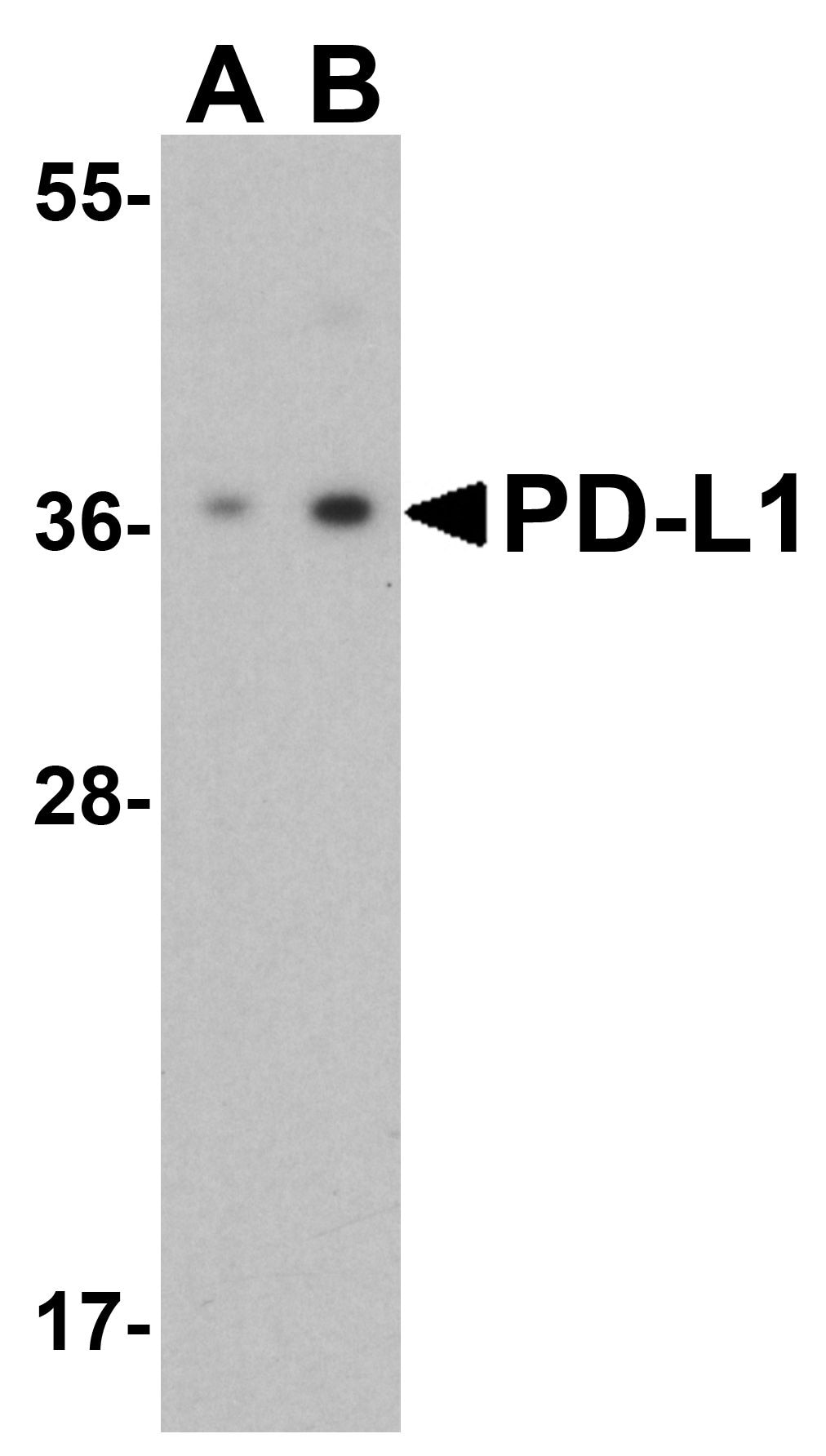 PD-L1 Antibody (PA5-20343)