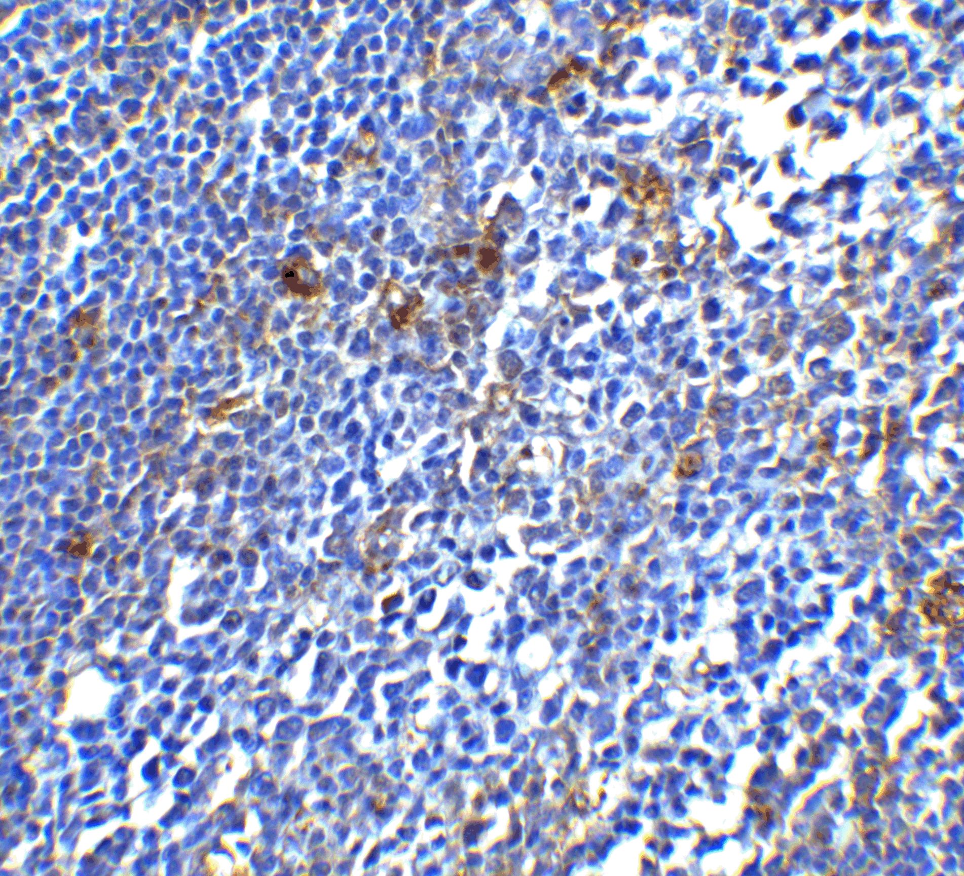 PD-1 Antibody (PA5-20350)