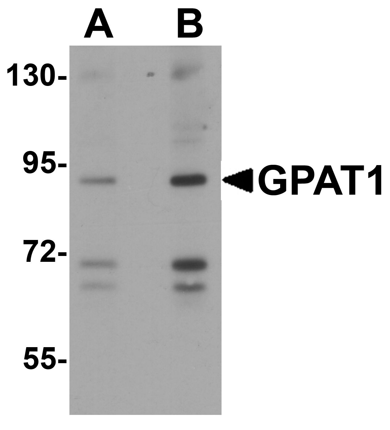 GPAM Antibody (PA5-20524)