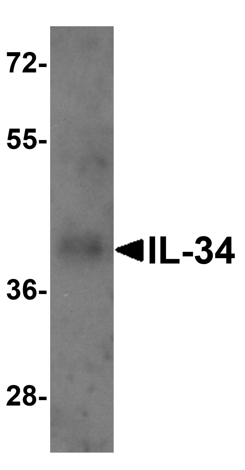 IL-34 Antibody (PA5-20585)
