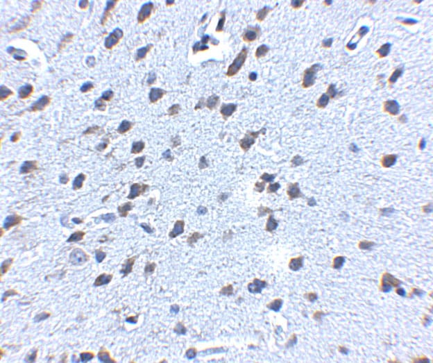 Amyloid Precursor Protein Antibody (PA5-20737)