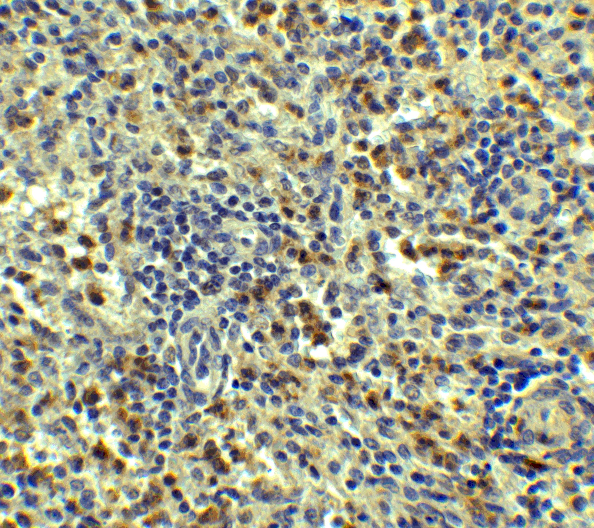 SQSTM1 Antibody (PA5-20839)