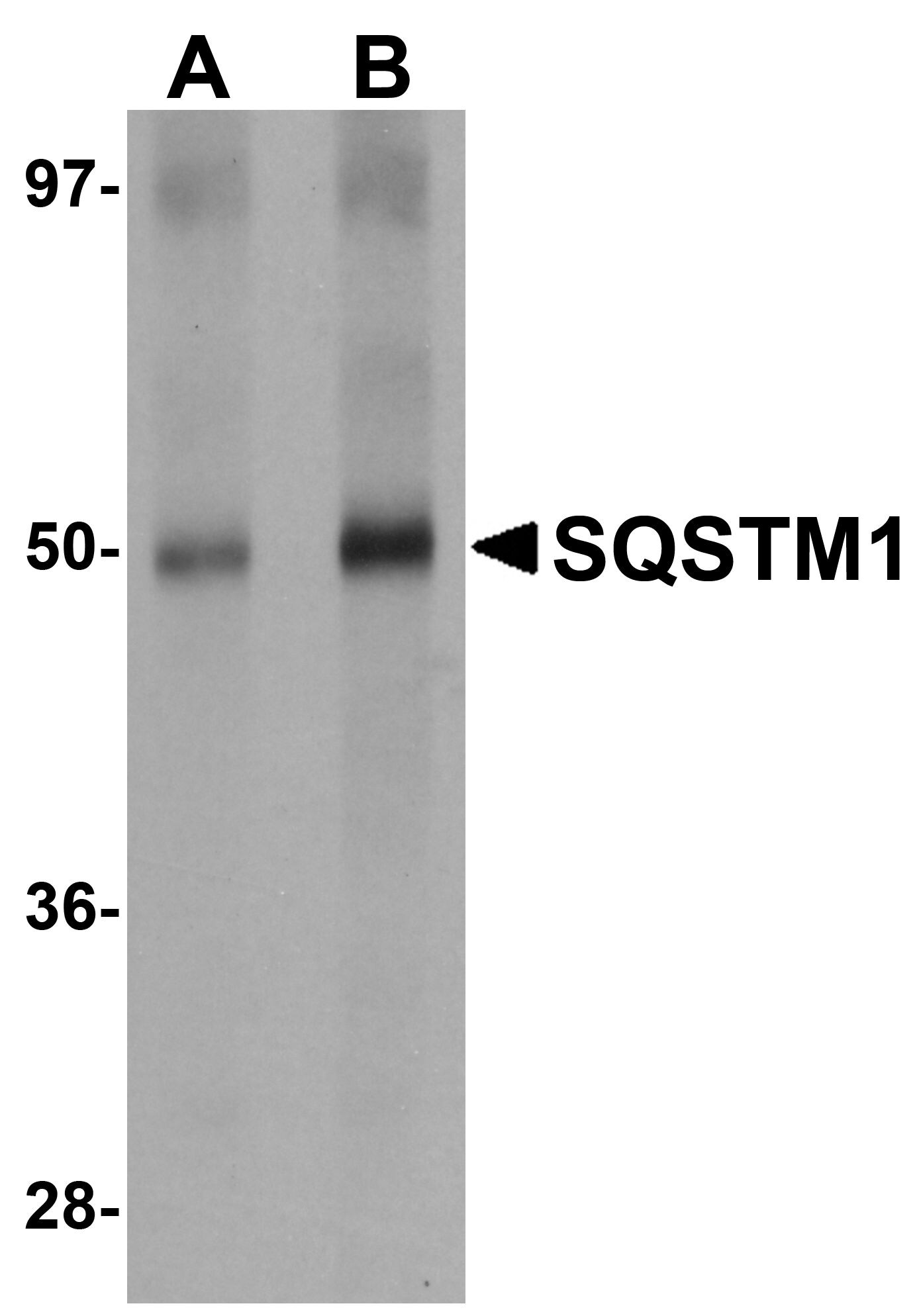 SQSTM1 Antibody (PA5-20839)