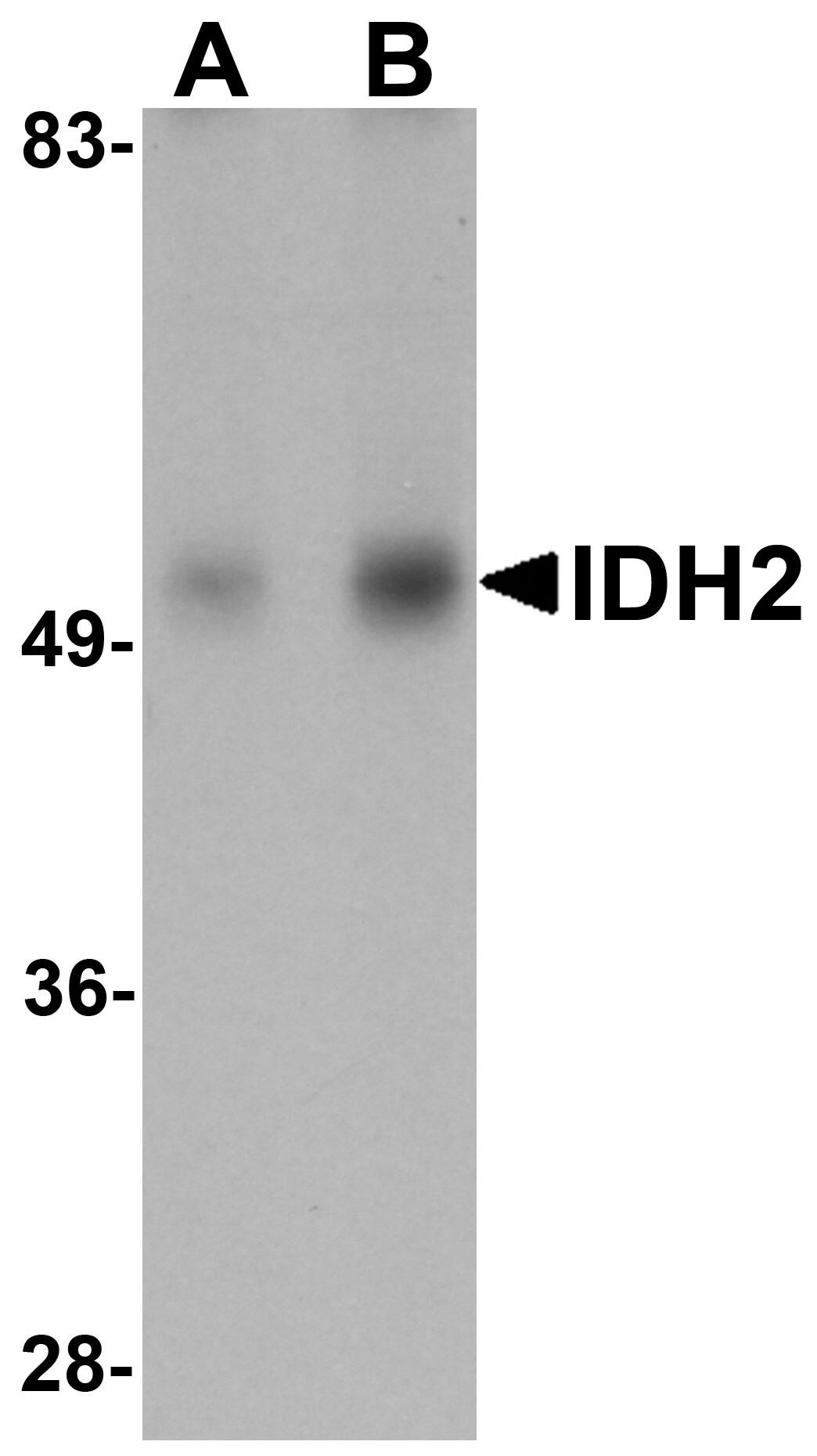 IDH2 Antibody (PA5-20977)