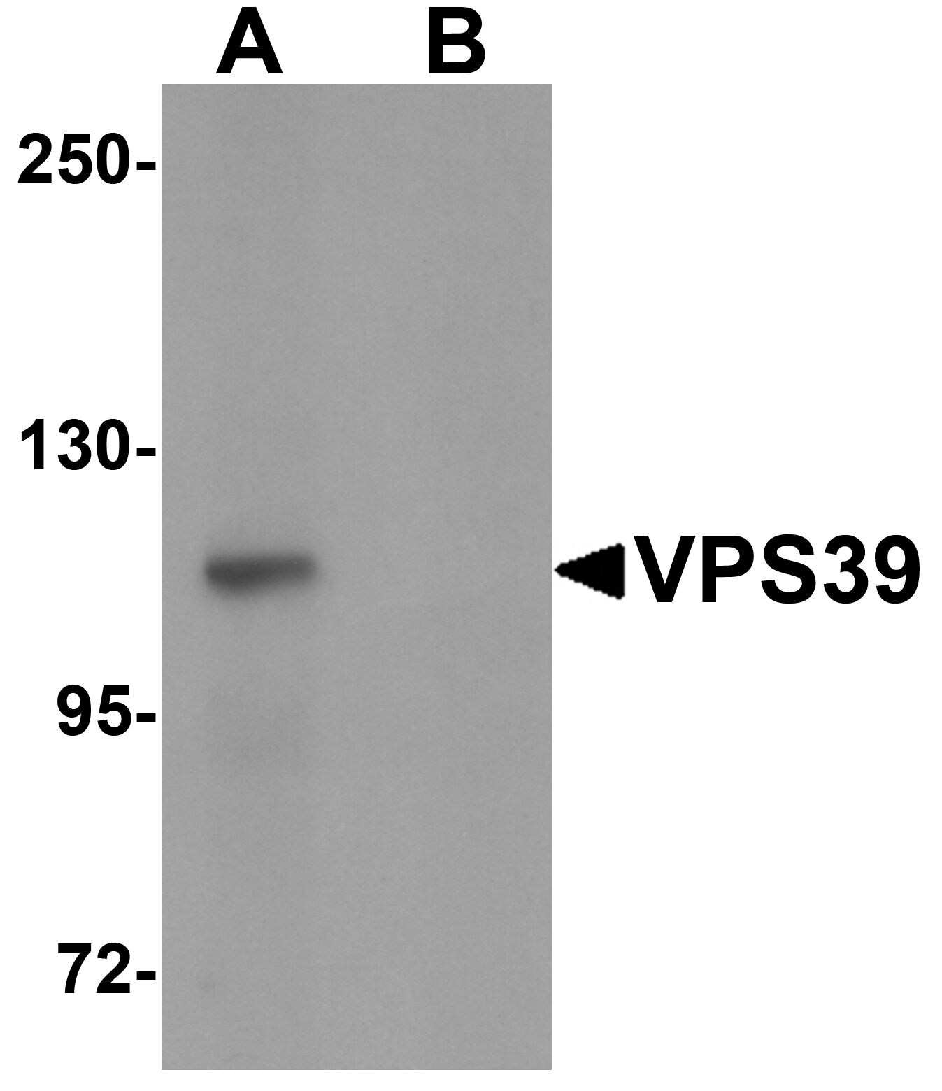 VPS39 Antibody (PA5-21104)