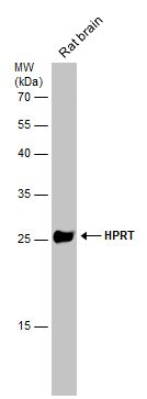 HPRT1 Antibody (PA5-21342)