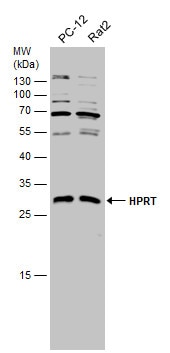 HPRT1 Antibody (PA5-21342)