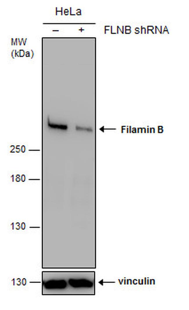 Filamin B Antibody (PA5-21345)