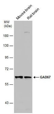 GAD67 Antibody (PA5-21397)