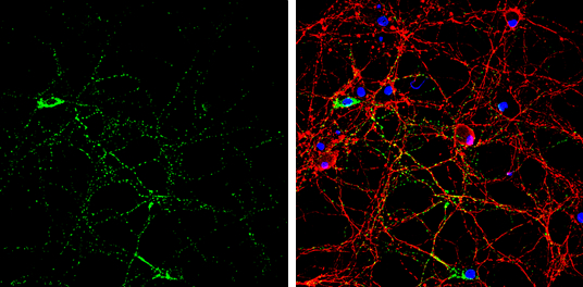 GAD65 Antibody (PA5-22260)
