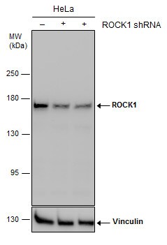ROCK1 Antibody (PA5-22262)