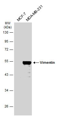 Vimentin Antibody (PA5-27231)