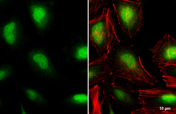 VHL Antibody (PA5-27322)