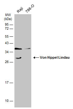 VHL Antibody (PA5-27322)