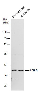 LDHB Antibody (PA5-27505)