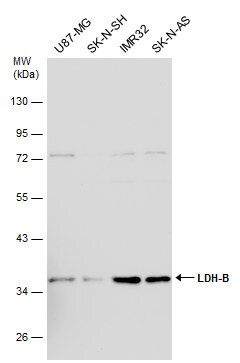 LDHB Antibody (PA5-27505)