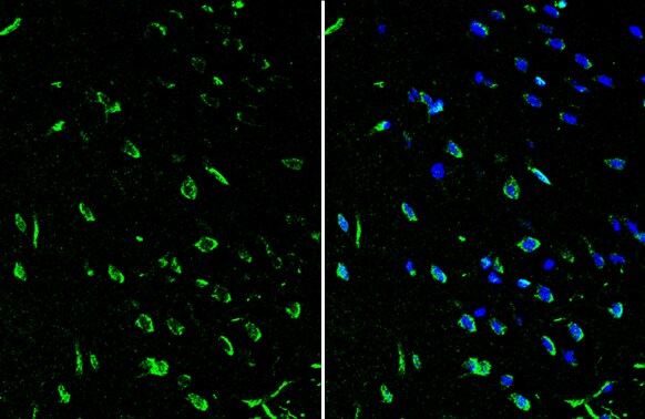 RORB Antibody (PA5-28742)