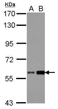 DKC1 Antibody (PA5-28922)