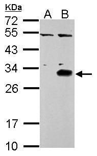 CHOP Antibody (PA5-28956)